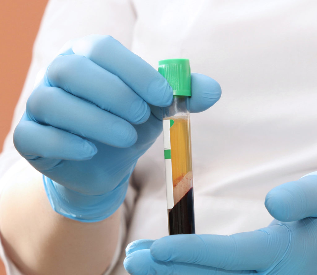 Bone Grafting - Shawnee, OK - Hopkins Dental Clinic